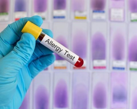 Sugar Land Allergy Testing Center | Lifetime Primary Care